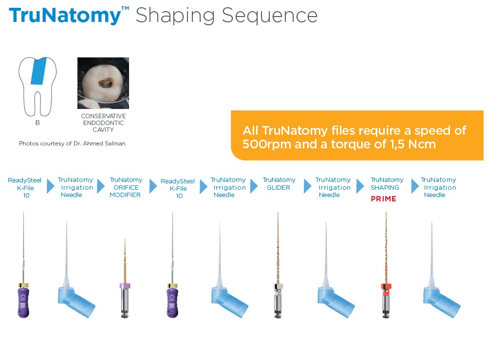 [트루나토미이리게이션니들30G(Dentsply)]